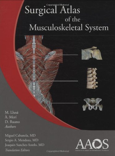 Amazon | Surgical Atlas Of The Musculoskeletal System | Perez, Manuel ...
