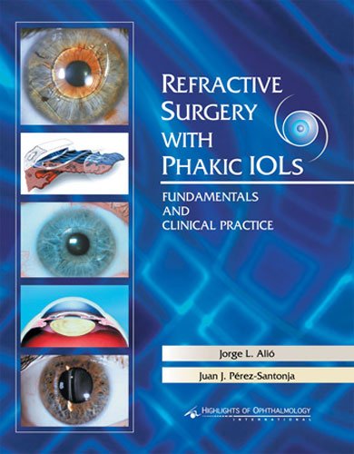 Refractive Surgery With Phakic Iols: Fun And Clinical....: Kinsella ...