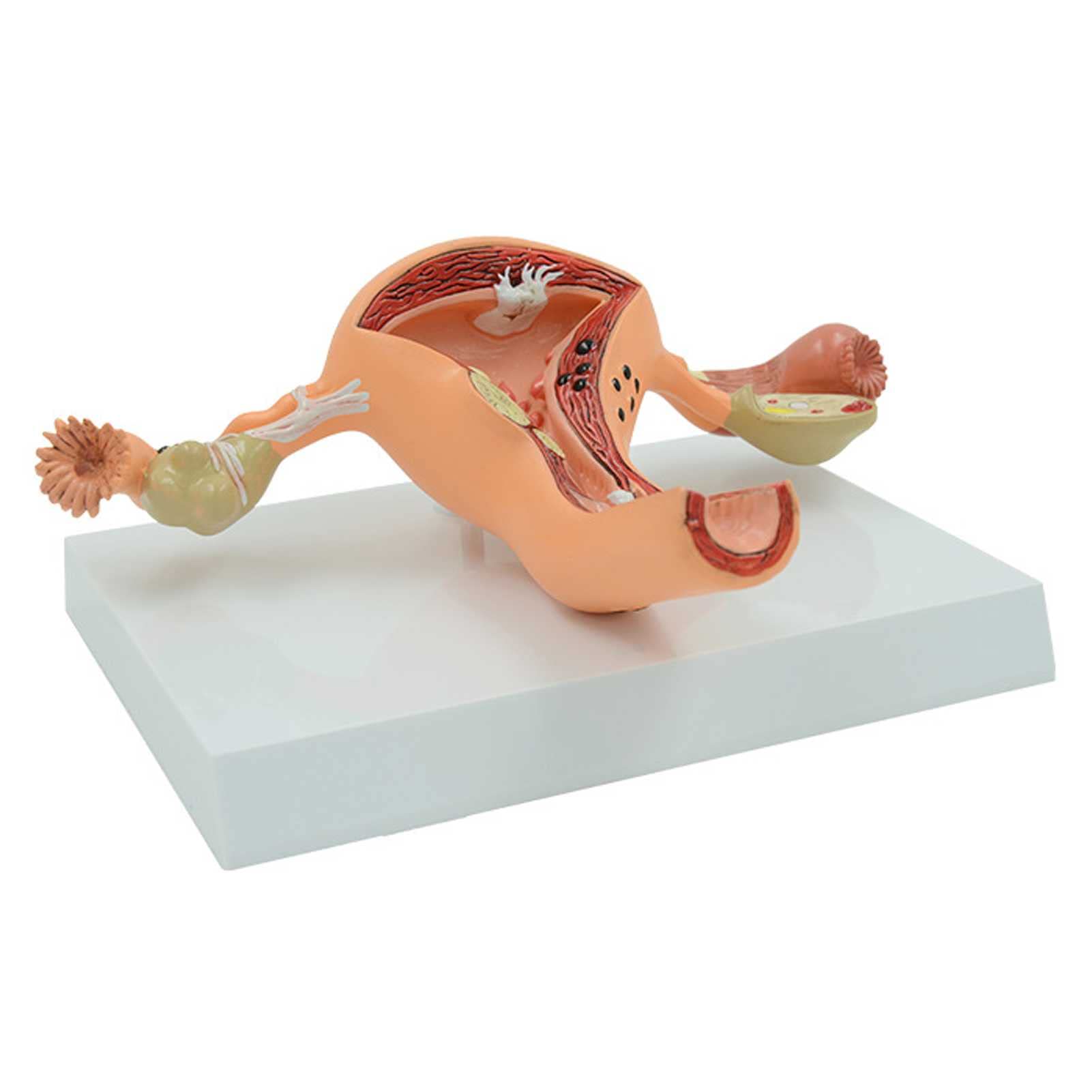 Uterine Model Anatomical Scientific Model Of Female Internal And ...