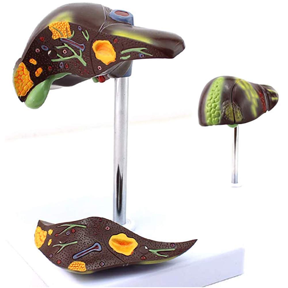 Buy Human Liver Anatomical Model Pathological Model of Pancreas Model ...