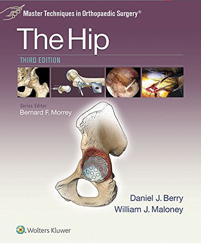 Master Techniques in Orthopaedic Surgery: The Hip eBook : Berry, Daniel ...