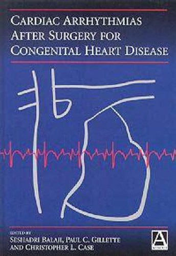 Amazon | Cardiac Arrhythmias After Surgery for Congenital Heart Disease ...