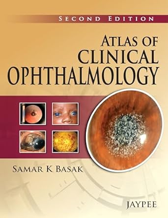Atlas of Clinical Ophthalmology eBook : Basak, Samar K: Amazon.co.uk: Books
