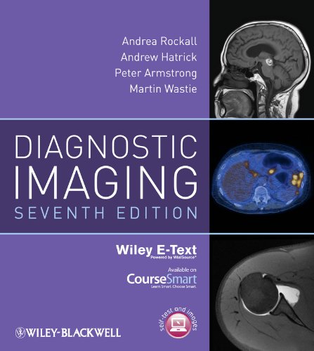 Amazon.co.jp: Diagnostic Imaging (English Edition) 電子書籍: Rockall ...