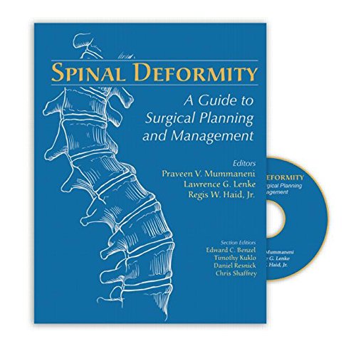 Spinal Deformity: A Guide to Surgical Planning and Management : Buy ...