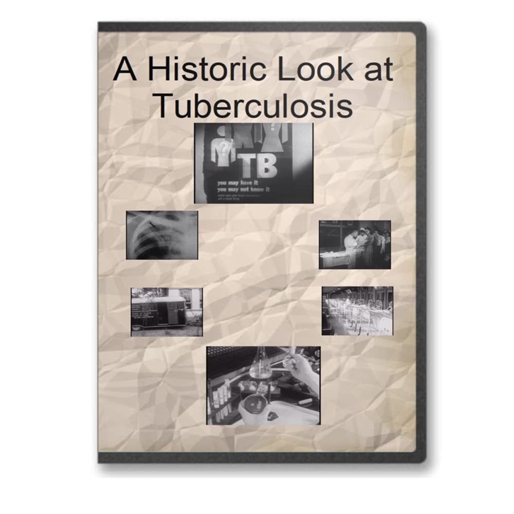 Amazon.com: A Historic Look At Tuberculosis on DVD : Movies & TV