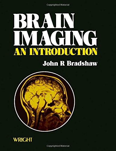 Brain Imaging: An Introduction: 9780723605966: Medicine & Health ...