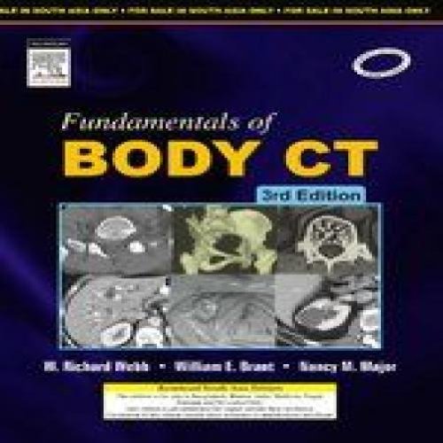 Fundamentals of Body CT, 3/e: WEBB, WEBB, WEBB: 9788131219706: Amazon ...