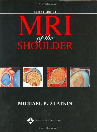 Mri of the Shoulder: 9780781715904: Medicine & Health Science Books ...