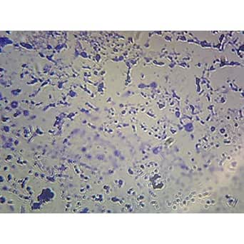 GSC S06332, Clostridium Tetani, Agent of Tetanus Prepared Microscope ...