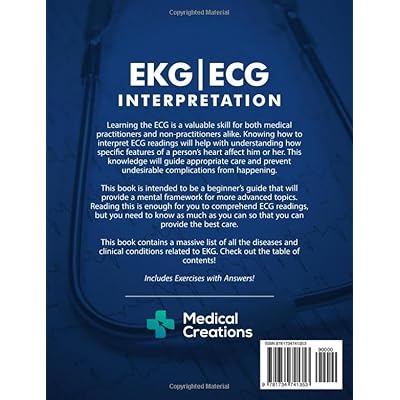 EKG/ECG Interpretation: Everything you Need to Know Philippines | Ubuy