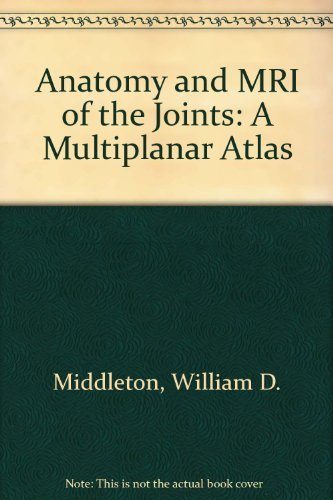 Anatomy and MRI of the Joints: A Multiplanar Atlas : Buy Online at Best ...