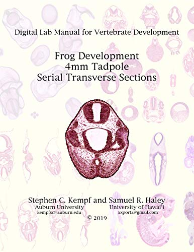 Amazon | 4mm Frog Tadpole Serial Transverse Sections: Digital Lab ...