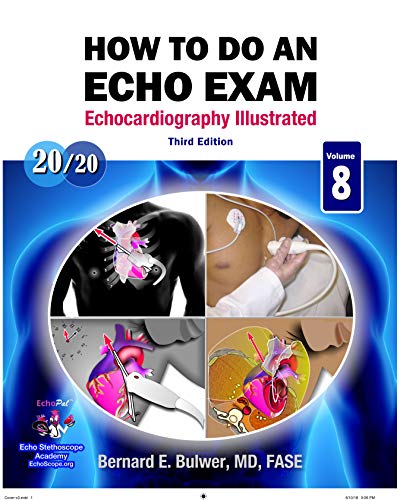 Amazon.com: How to Do An Echo Exam: Third Edition (Echocardiography ...