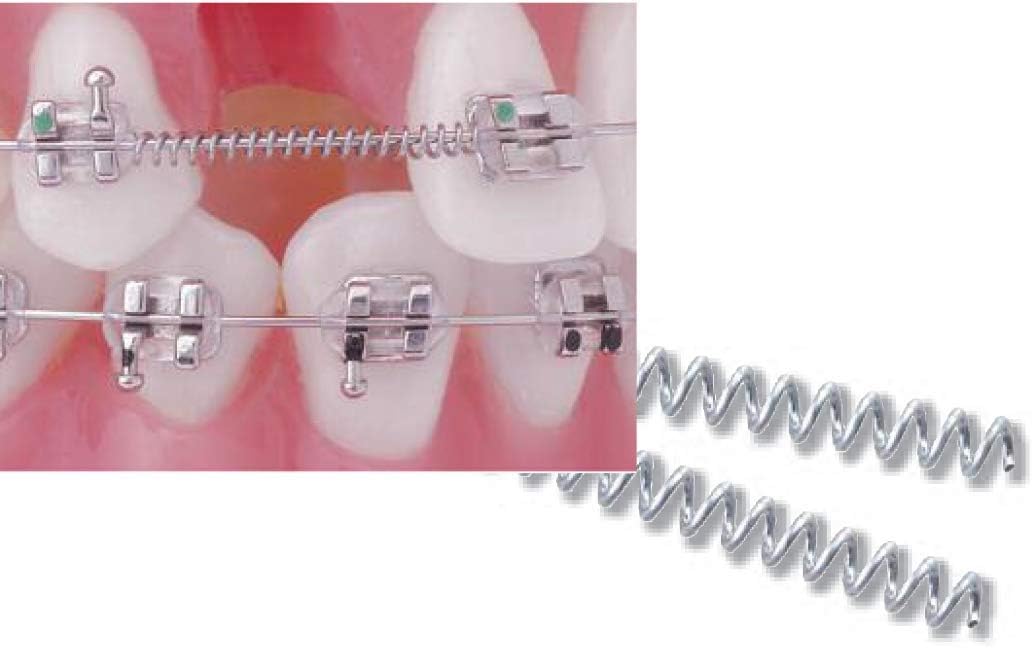 Niti Open Coil Spring Dental Ortodoncia Ortodoncista Dental Dentista ...