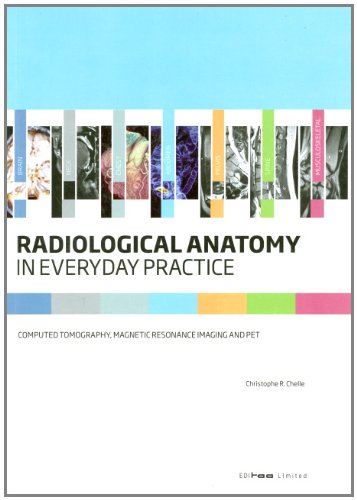 Radiological Anatomy in Everyday Practice: Computed Tomography ...