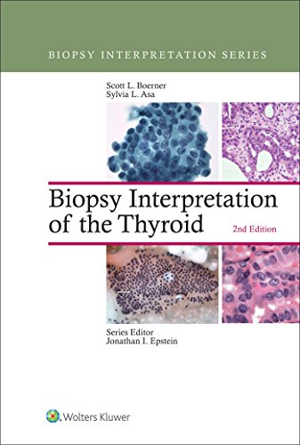 Amazon.com: Biopsy Interpretation of the Thyroid (Biopsy Interpretation ...