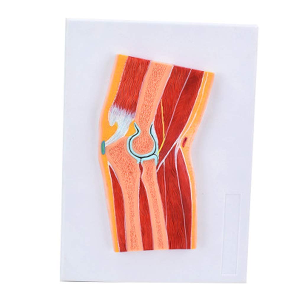 Buy DBSCD Skeletal Muscle Model of Elbow Joint-Elbow Joint Structure ...