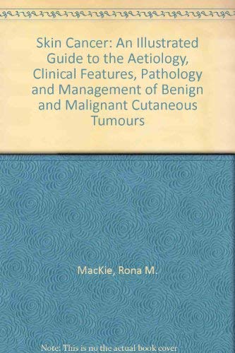 Skin Cancer: An Illustrated Guide to the Aetiology, Clinical Features ...