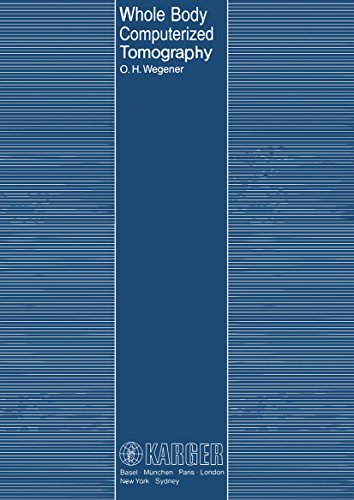 Amazon.com: Whole Body Computerized Tomography: Practical Image ...