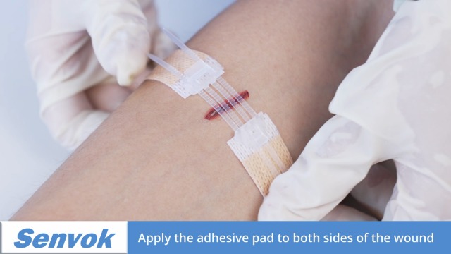 Watch Zip Stitch Sutures Bandaids first aid kit on Amazon Live