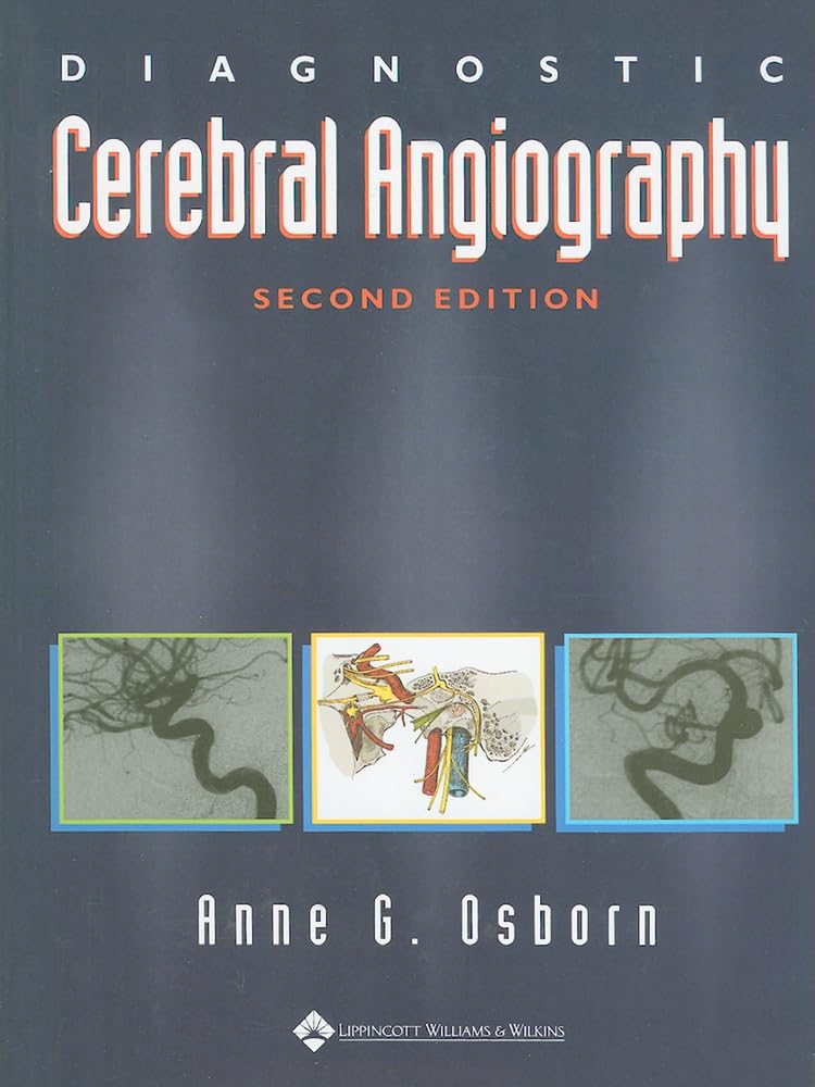 Diagnostic Cerebral Angiography: 9780397584048: Medicine & Health ...