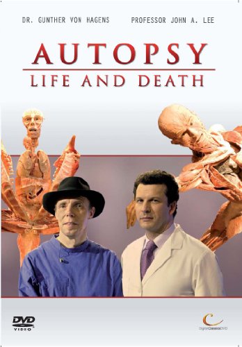 Amazon.com: Autopsy: Life And Death [DVD] : Movies & TV