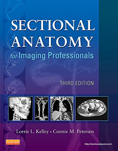 Sectional Anatomy for Imaging Professionals - Elsevier Ebook on ...