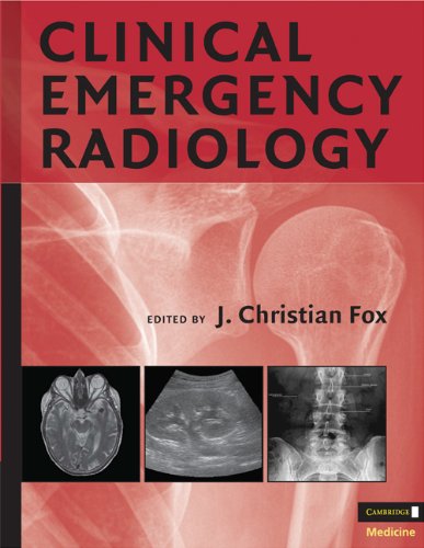 Clinical Emergency Radiology: 9780521870542: Medicine & Health Science ...