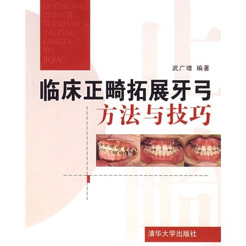 clinical orthodontic arch expansion methods and techniques: WU GUANG ...