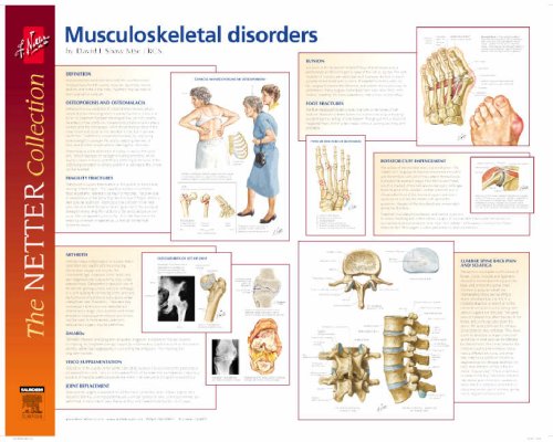 Buy Frank H. Netter Musculoskeletal Disorders Poster (European Netter ...