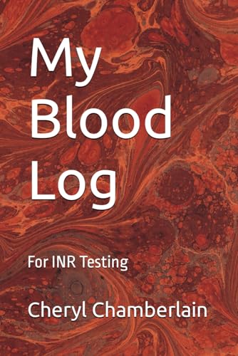 My Chamberlain – The 15 best products compared - Your Motor Guide