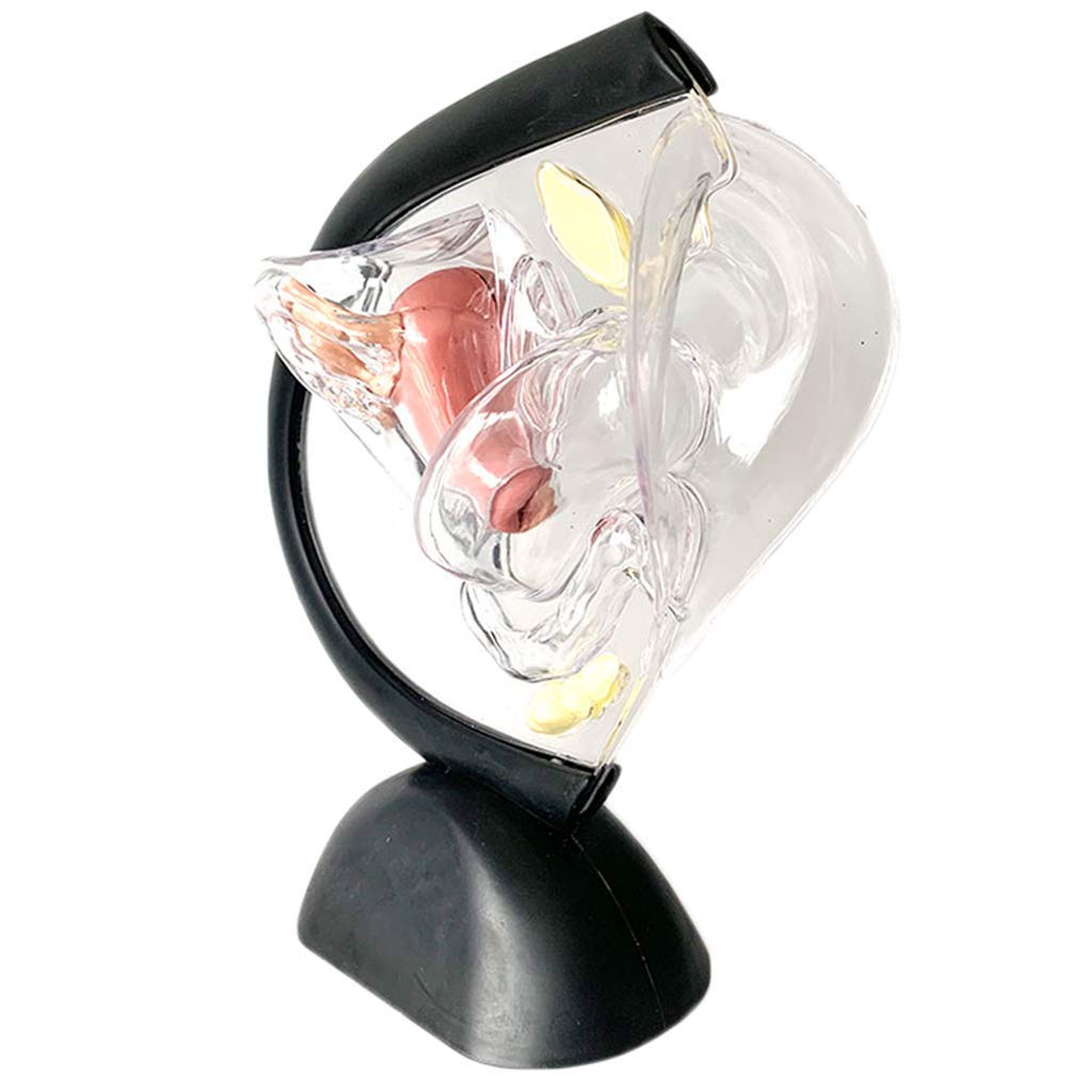 Study Model Transparent Uterus Model Pathological Uterine Reproductive ...