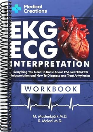 EKG/ECG Interpretation: Everything you Need to Know about the 12 - Lead ...