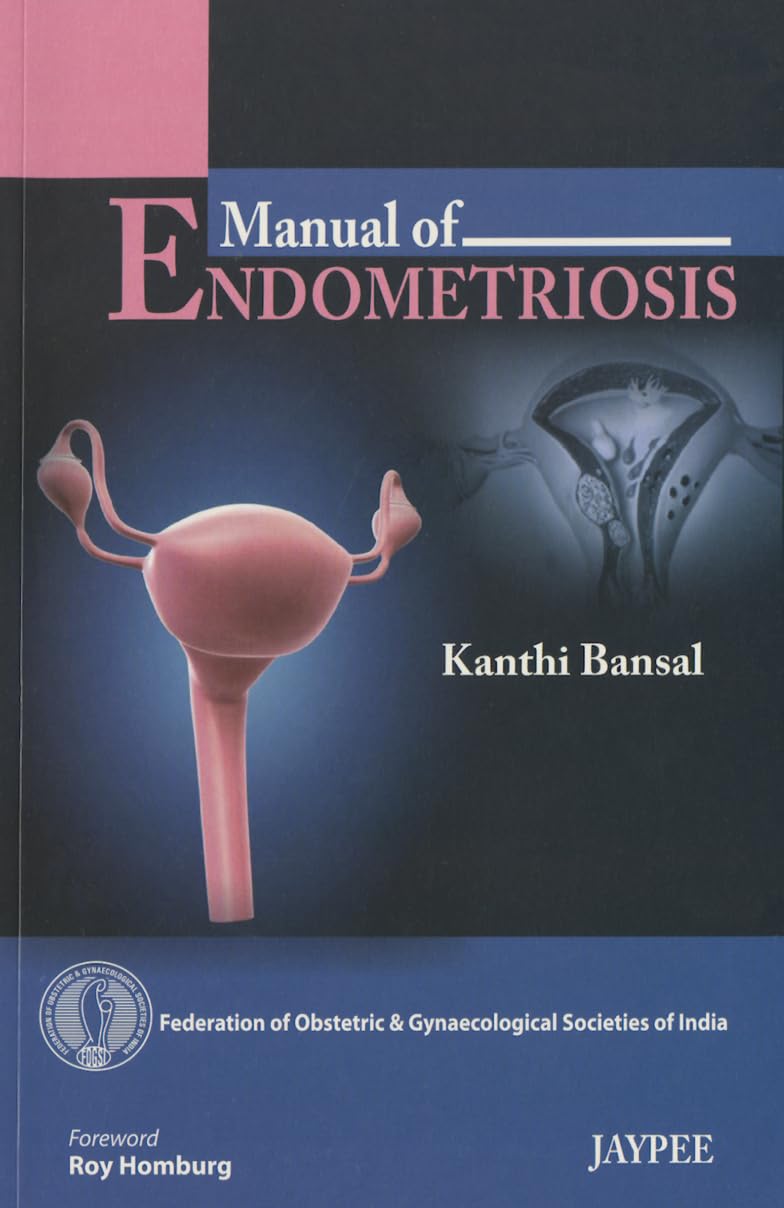 Manual of Endometriosis: 9789350904046: Medicine & Health Science Books ...