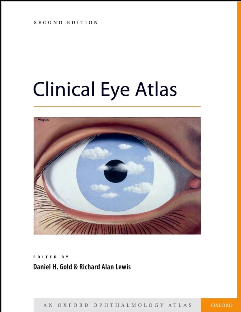 Clinical Eye Atlas (Oxford Atlases in Ophthalmology): 9780195342178 ...