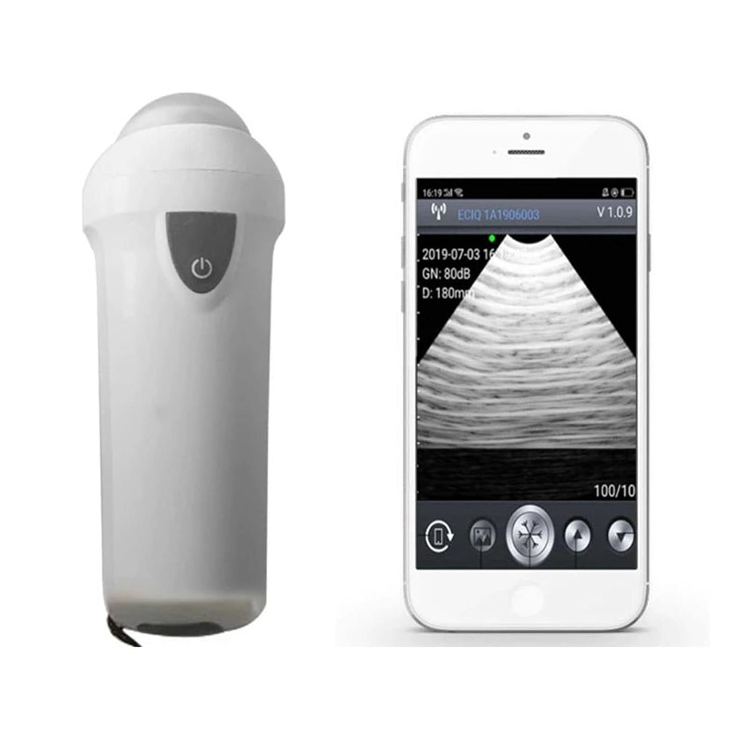 Ultrasound Machine for Pregnancy,Wireless Portable Ultrasound Scanner ...