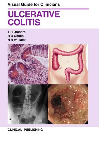 Buy Ulcerative Colitis (Visual Guide for Clinicians) Book Online at Low ...