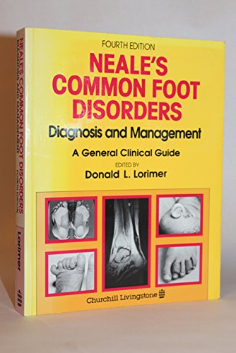 Buy Common Foot Disorders: Diagnosis and Management Book Online at Low ...