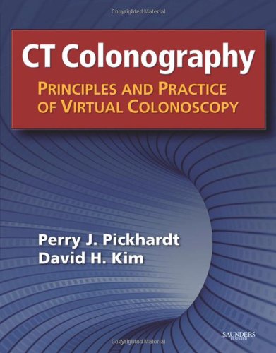 CT Colonography: Principles and Practice of Virtual Colonoscopy ...