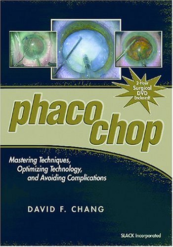 Phaco Chop: Mastering Techniques, Optimizing Technology, and Avoiding Complications ...