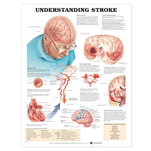 Understanding Stroke Chart | Amazon.com.br