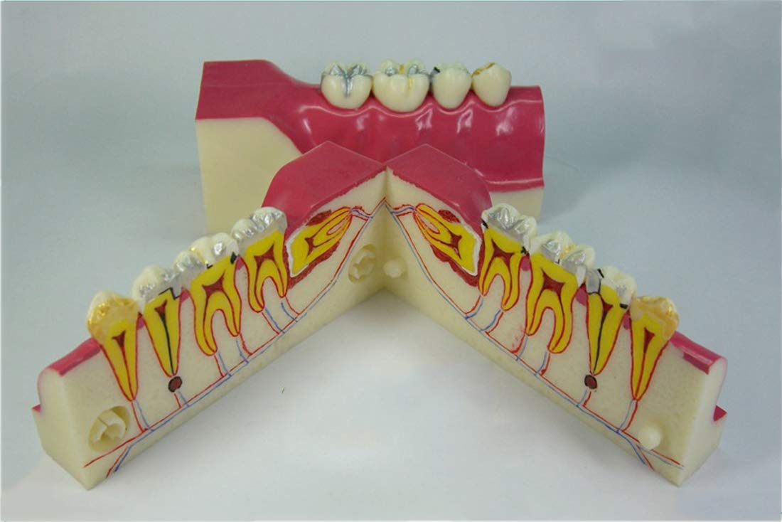 Educational Model Decomposition Model Of Right Lower Posterior Teeth ...