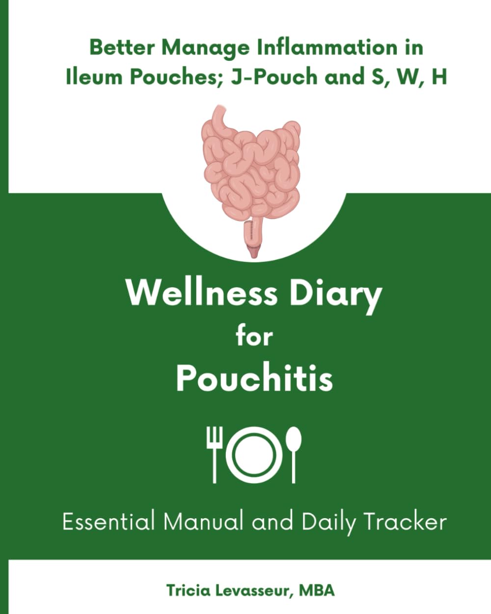 J Pouch Pouchitis Treatment at Clara Stamps blog