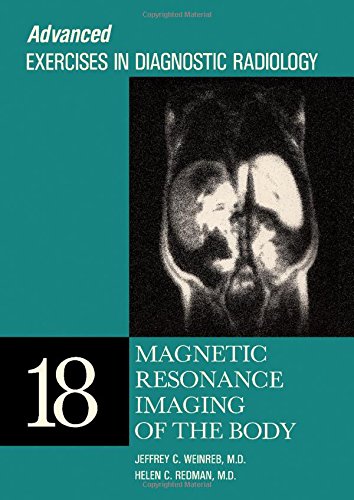 Magnetic Resonance Imaging of the Body: Advanced Exercises in ...