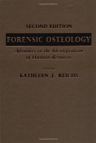 Amazon.com: Forensic Osteology: Advances in the Identification of Human ...