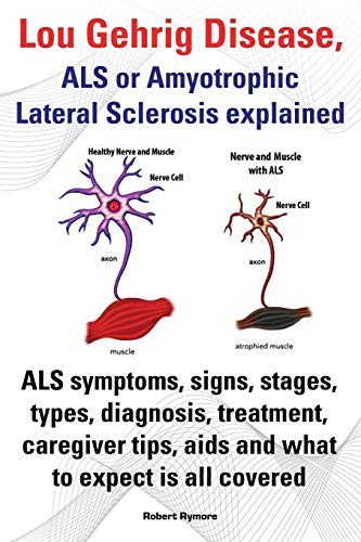 Lou Gehrig Disease Als Or Amyotrophic Lateral Sclerosis Explained Als ...