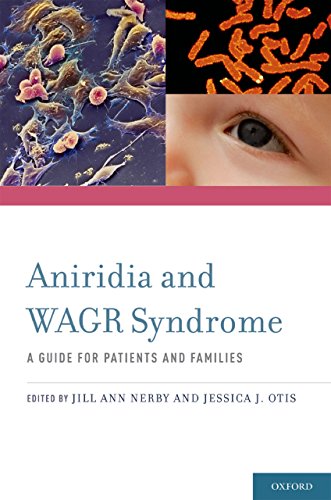 Aniridia and WAGR Syndrome: A Guide for Patients and Their Families ...