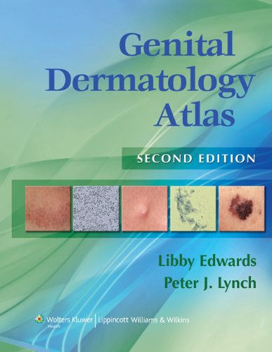 Genital Dermatology Atlas (English Edition) - eBooks em Inglês na ...