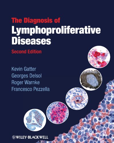 Amazon.com: The Diagnosis of Lymphoproliferative Diseases eBook ...